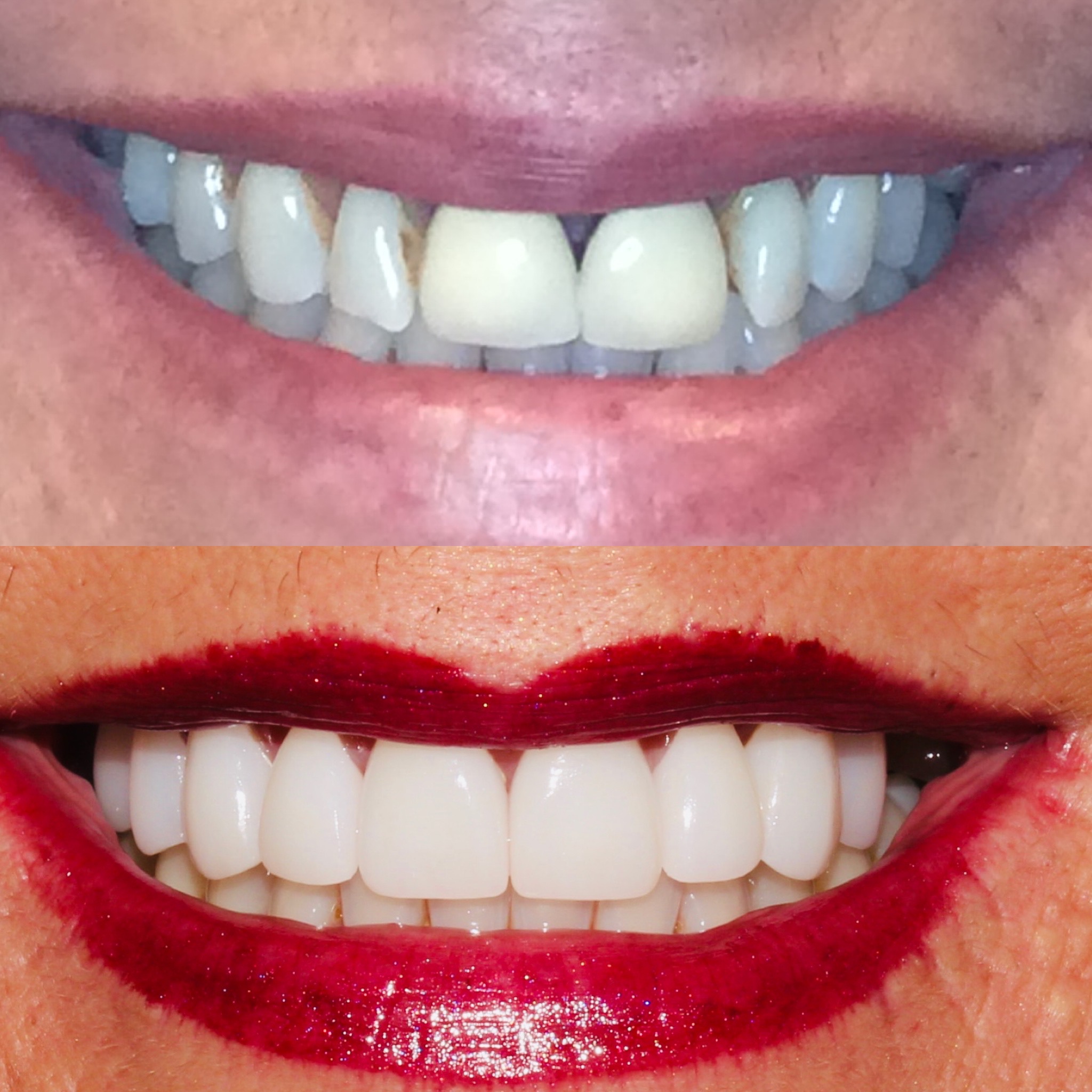 General Dentist Lumberton, TX | Dental Square | General Care